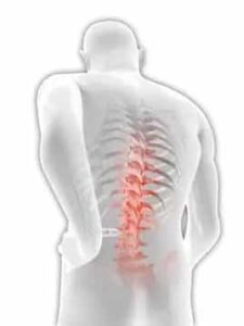Slip Disc: Your Non-Surgical Options