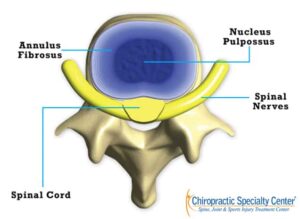 Fragmented Disc: Safe Non-Invasive Care Options